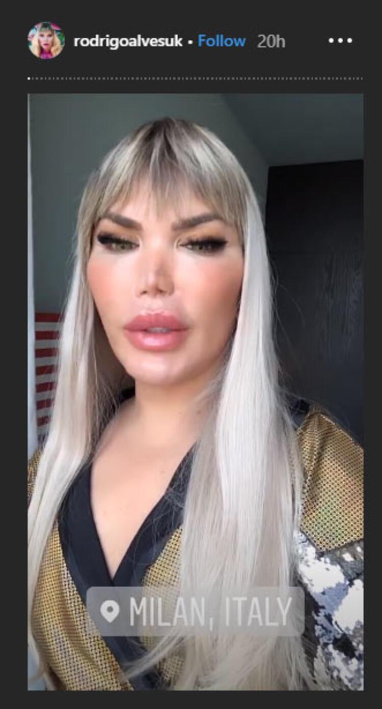 Rodrigo Alves, geçirdiği 70'e yakın estetik ameliyat sonrası artık bir ...