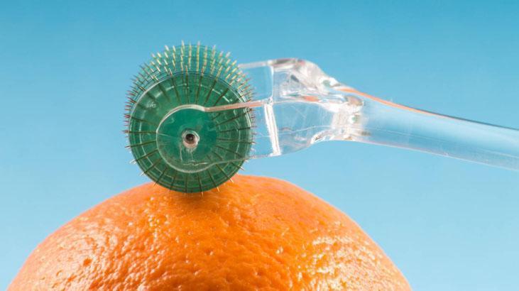 Dermaroller herkese iyi gelmiyor! Deneyenler uyardı, böyle yapılırsa ...