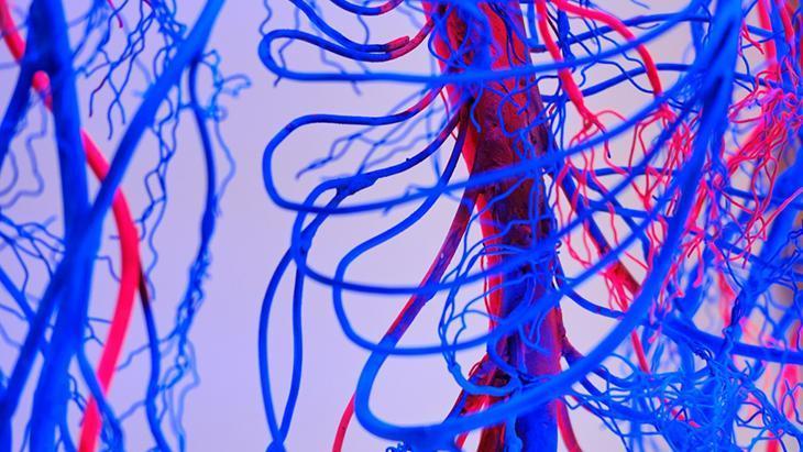 Son yıllarda hızla yaygınlaşıyor! Bu hatalar damarlarımızı tıkıyor ...