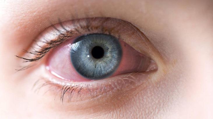 'Kedi gözü' trendi korkunç bir hâl aldı! Doktorlar şaşkın, efekt için ...