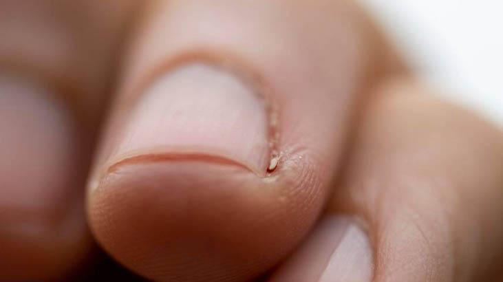 Tatlı gelse de şeytan tırnaklarını koparmayın! Meğer çözümü çok ...