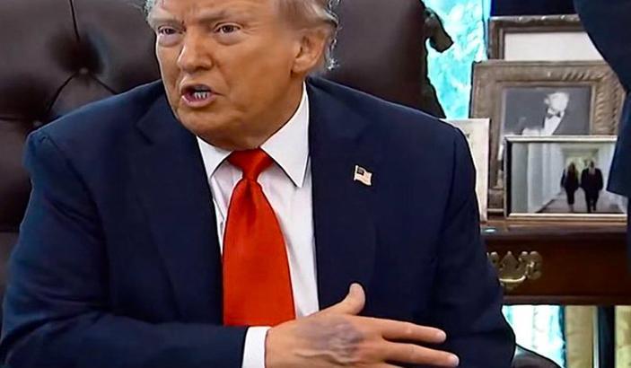 TRUMP'IN ELİ NEDEN MORARDI? Kronik Venöz yetmezlik nedir? Venöz ...