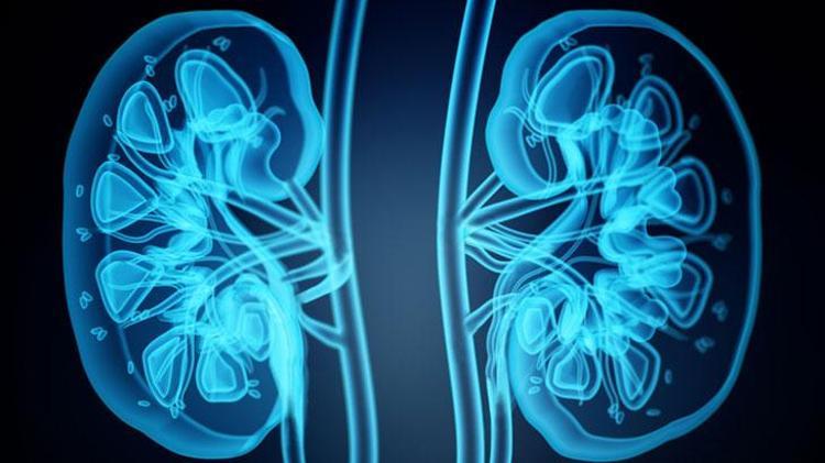 Böbrek taşını kırmaktan beter ediyor! İşte böbrek taşını düşürmenin en ...