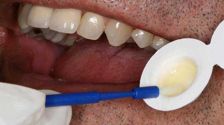 Florun faydaları - Ortodontist Dr Yasin Akgül