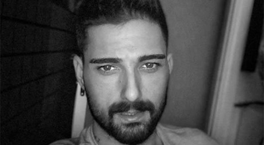 İdo Tatlıses’in estetik sonrası ilk hali - Magazin Haberleri - Milliyet