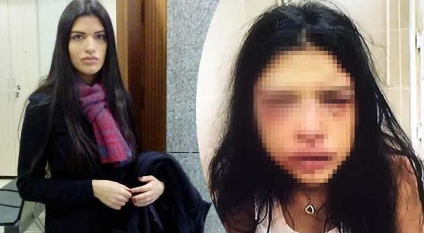 Melis Çakır ifade değiştirdi - Güncel Haberler Milliyet