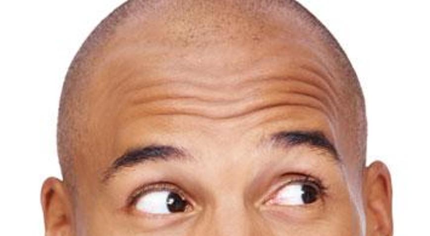 Kel erkek yatakta daha mı iyi? - Aşk