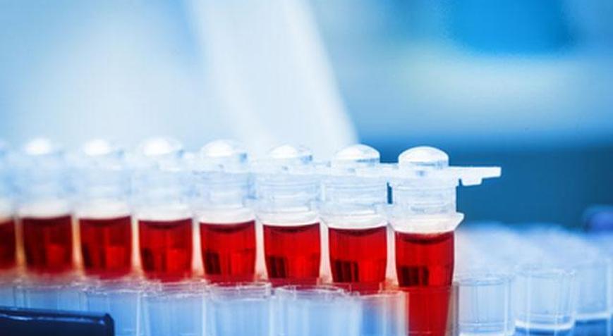 Talasemi nedir, nasıl anlaşılır? - Sağlık Haberleri