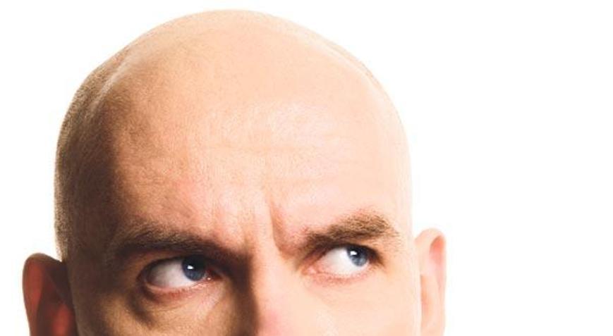 Kel erkek daha güçlü görünüyor - Son Dakika Haberler Milliyet