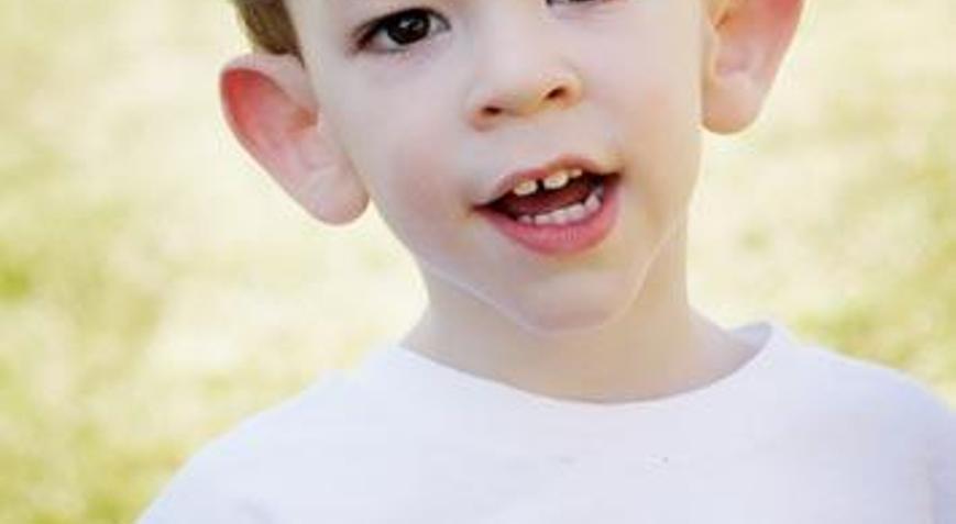 Frajil X Sendromu - Sağlık Haberleri