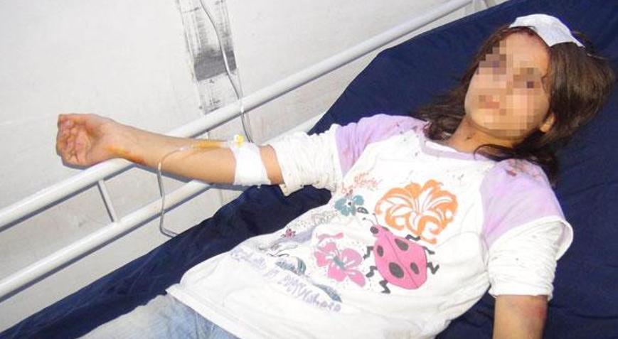 11 Yaşındaki çocuğa üvey Anne şiddeti Haberler Milliyet