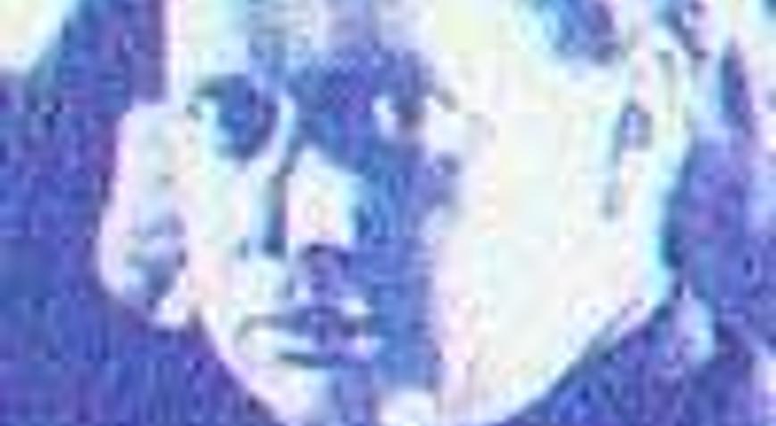 Dylan kortizondan öldü - Yaşam Haberleri