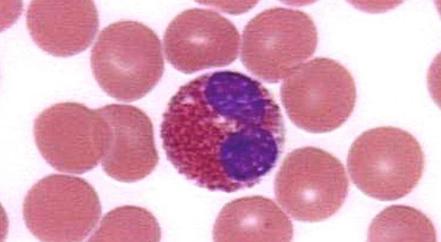 Eozinofil Nedir? Eozinofil Kaç Olmalı? Yüksekliği Ve Düşüklüğü ...