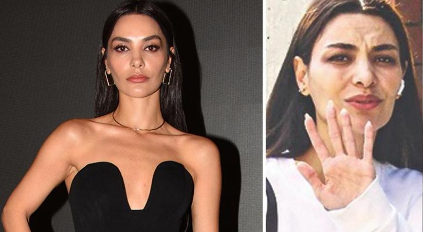 Hazal Filiz Küçükköse'den makyajsız fotoğraf sitemi! - Magazin ...