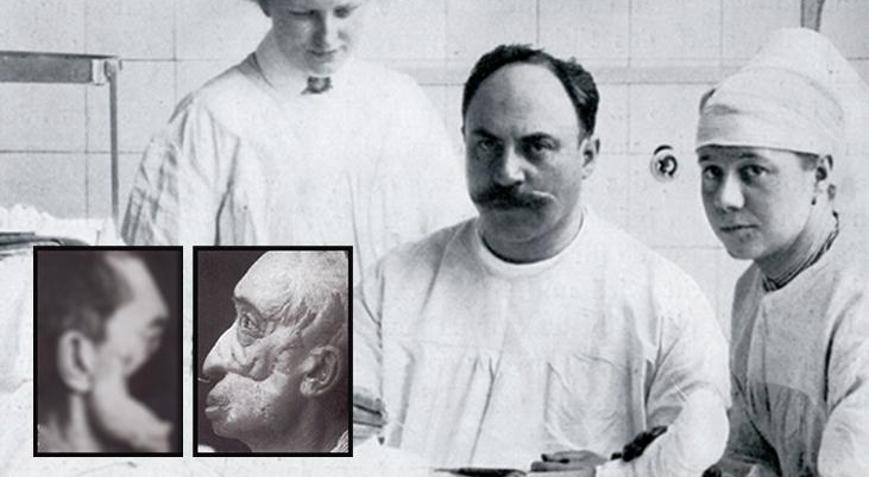 Türk asker yüzünü Çanakkale'de kaybetti! 'Buruncu Joseph' mucizeler ...