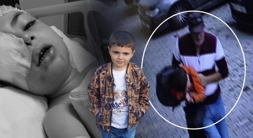 İndiği okul servisinin altında kalmıştı: Emre gözlerini kaybetme tehlikesi ile karşı karşıya ...